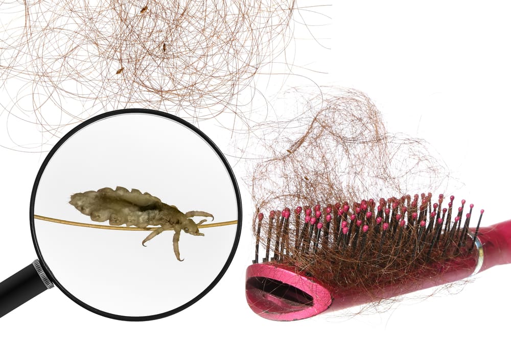 Hoofdluizen Bestrijden Tips 2025 | Hoofdluis Verdelgen met Millium.nl